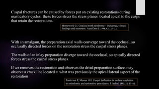 Cracks in Endodontics | PPTX
