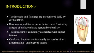 Cracks in Endodontics | PPTX