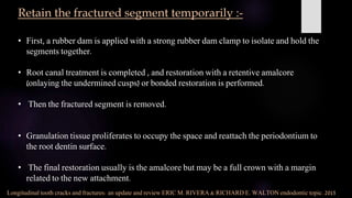 Cracks in Endodontics | PPTX