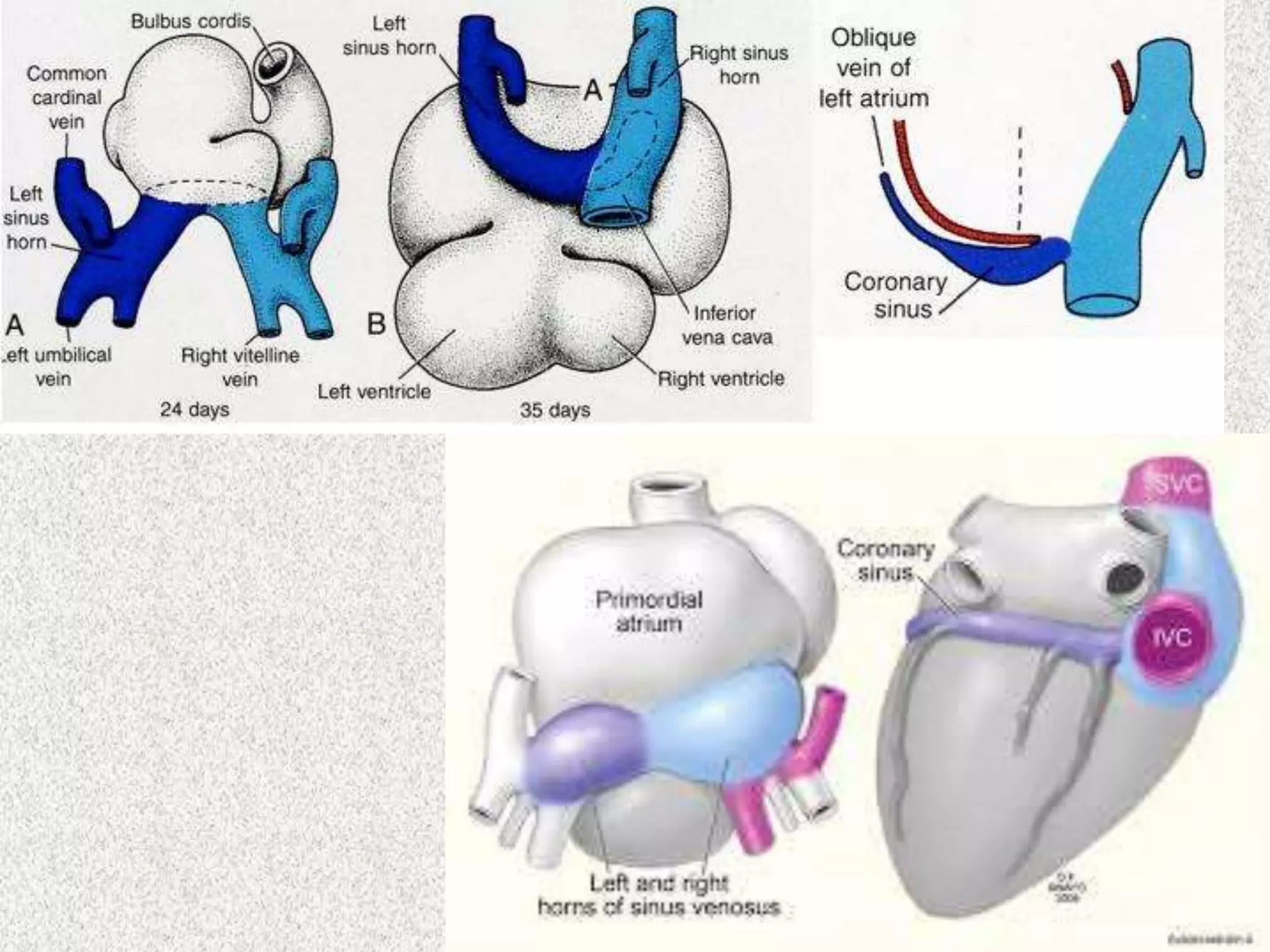 CORONARY SINUS | PPTX