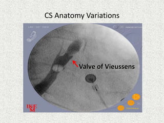CORONARY SINUS | PPTX