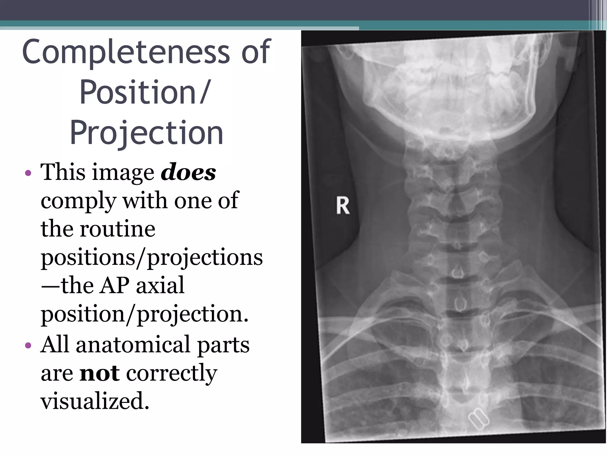 Image Evaluation: AP Axial C-Spine | PPTX