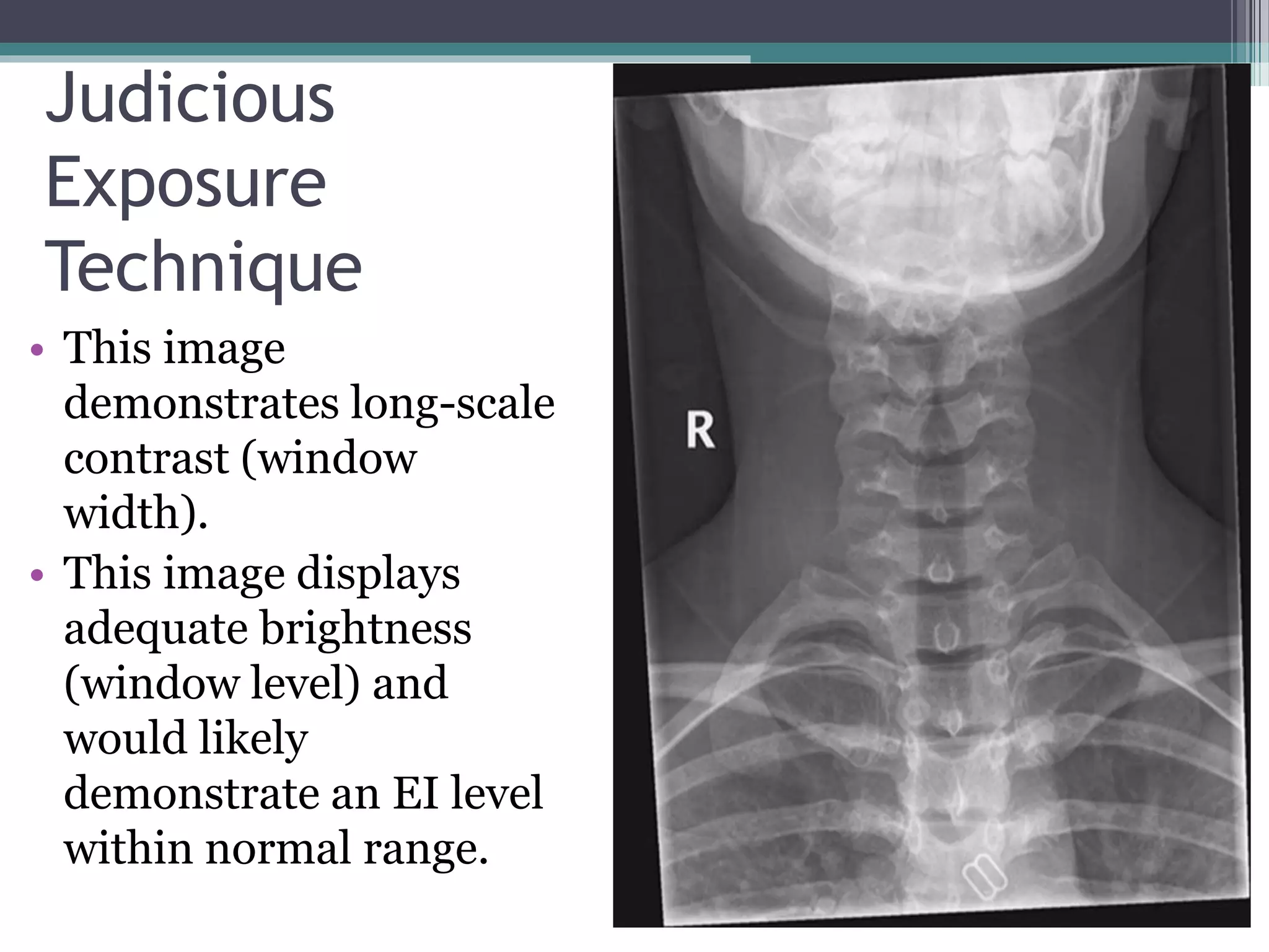 Image Evaluation: AP Axial C-Spine | PPTX