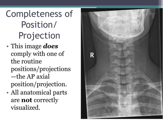 Image Evaluation: AP Axial C-Spine | PPTX