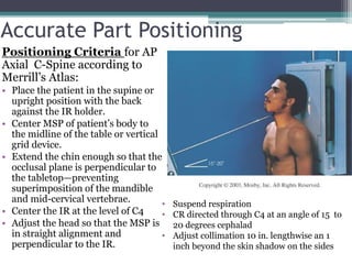 Image Evaluation: AP Axial C-Spine | PPTX