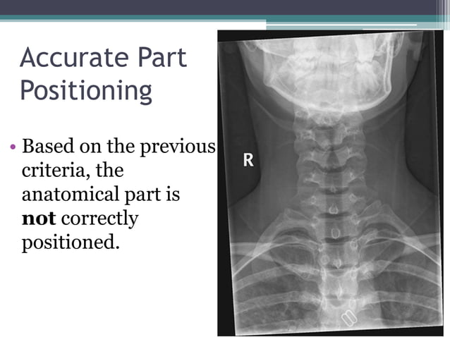 Image Evaluation: AP Axial C-Spine | PPTX
