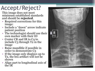 Image Evaluation: AP Axial C-Spine | PPTX