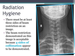 Image Evaluation: AP Axial C-Spine | PPTX