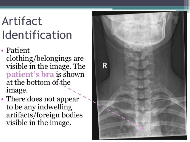 Image Evaluation: AP Axial C-Spine