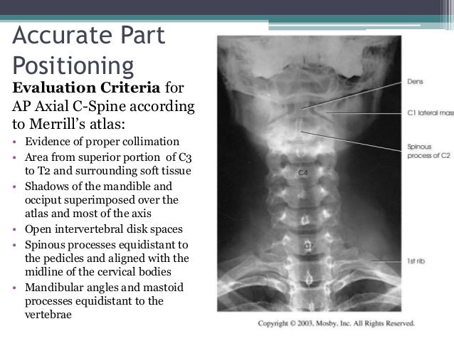 Image Evaluation: AP Axial C-Spine