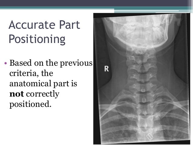 Image Evaluation: AP Axial C-Spine