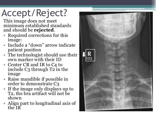 Image Evaluation: AP Axial C-Spine