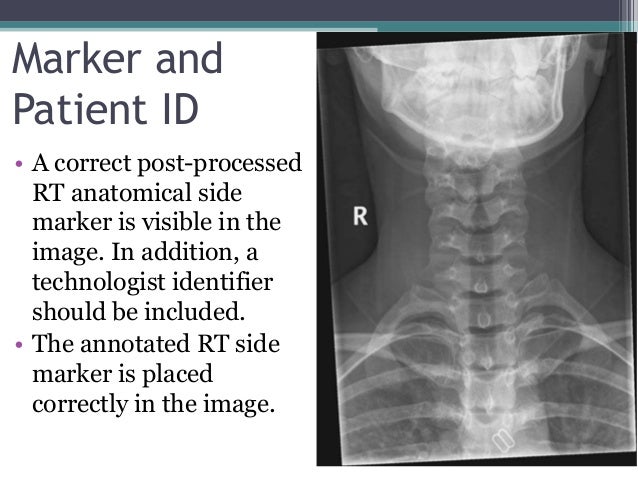 Image Evaluation: AP Axial C-Spine