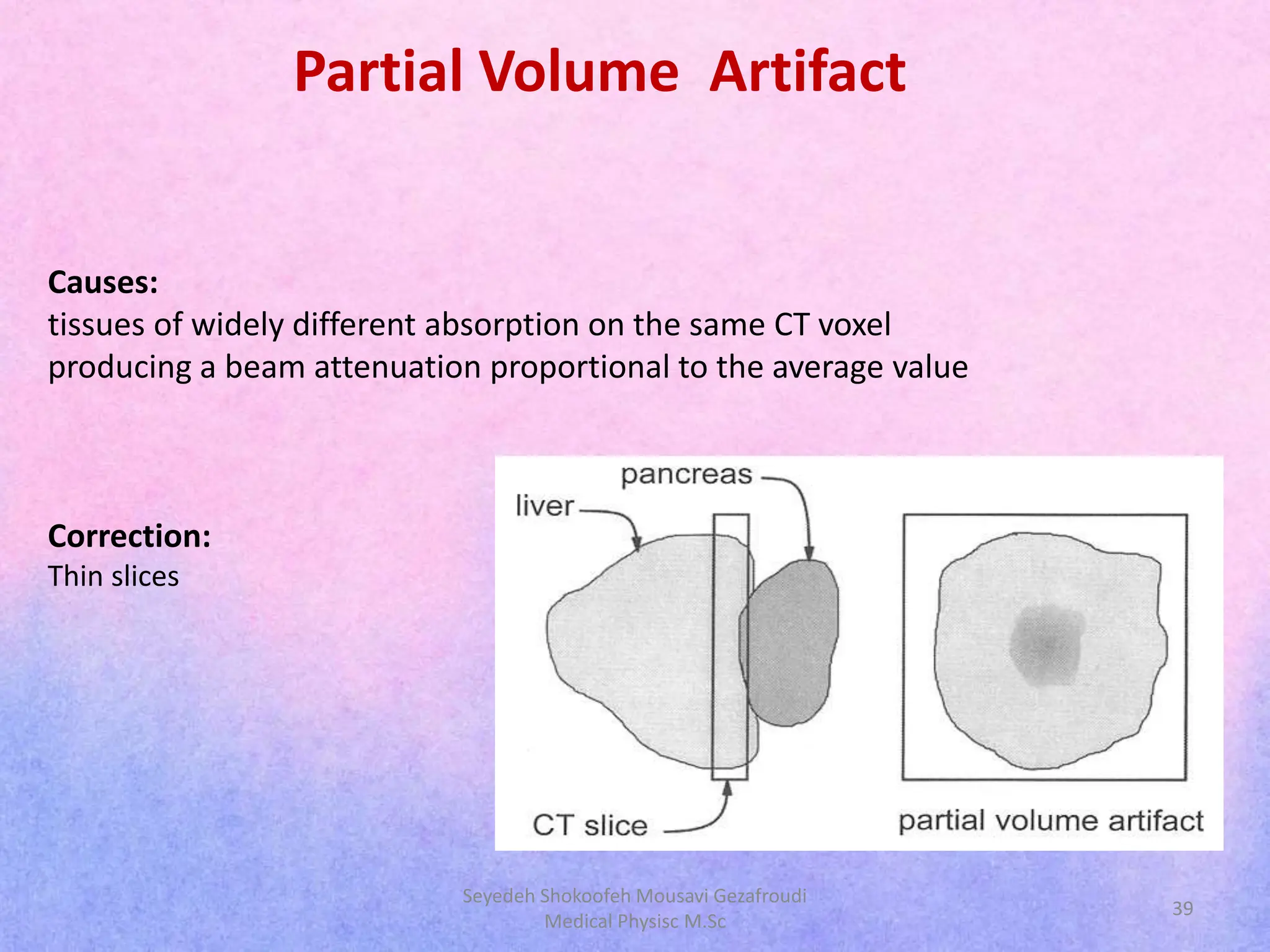 Head & Neck CT Angiography | PPTX