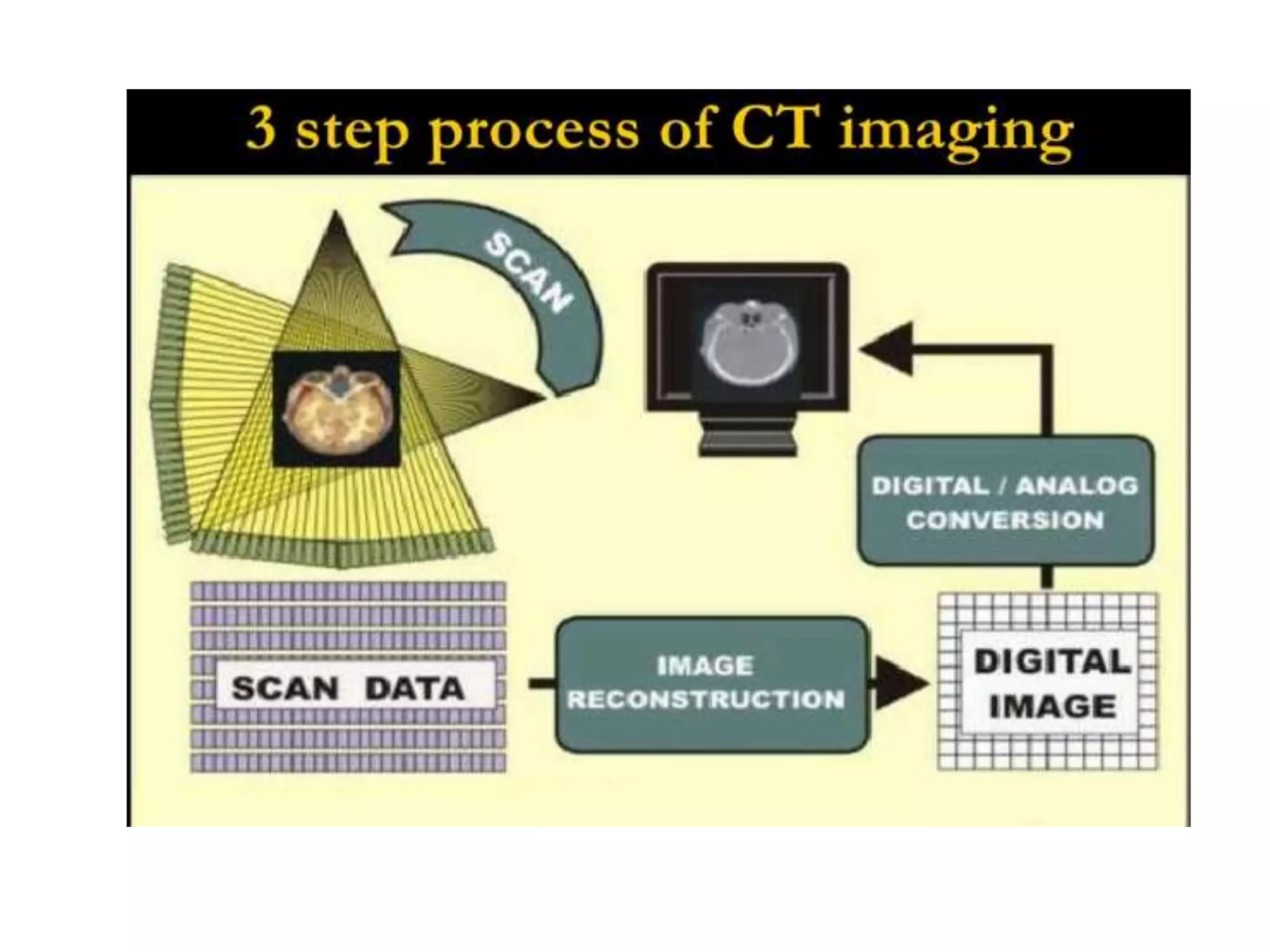 BASICS of CT Head | PPTX