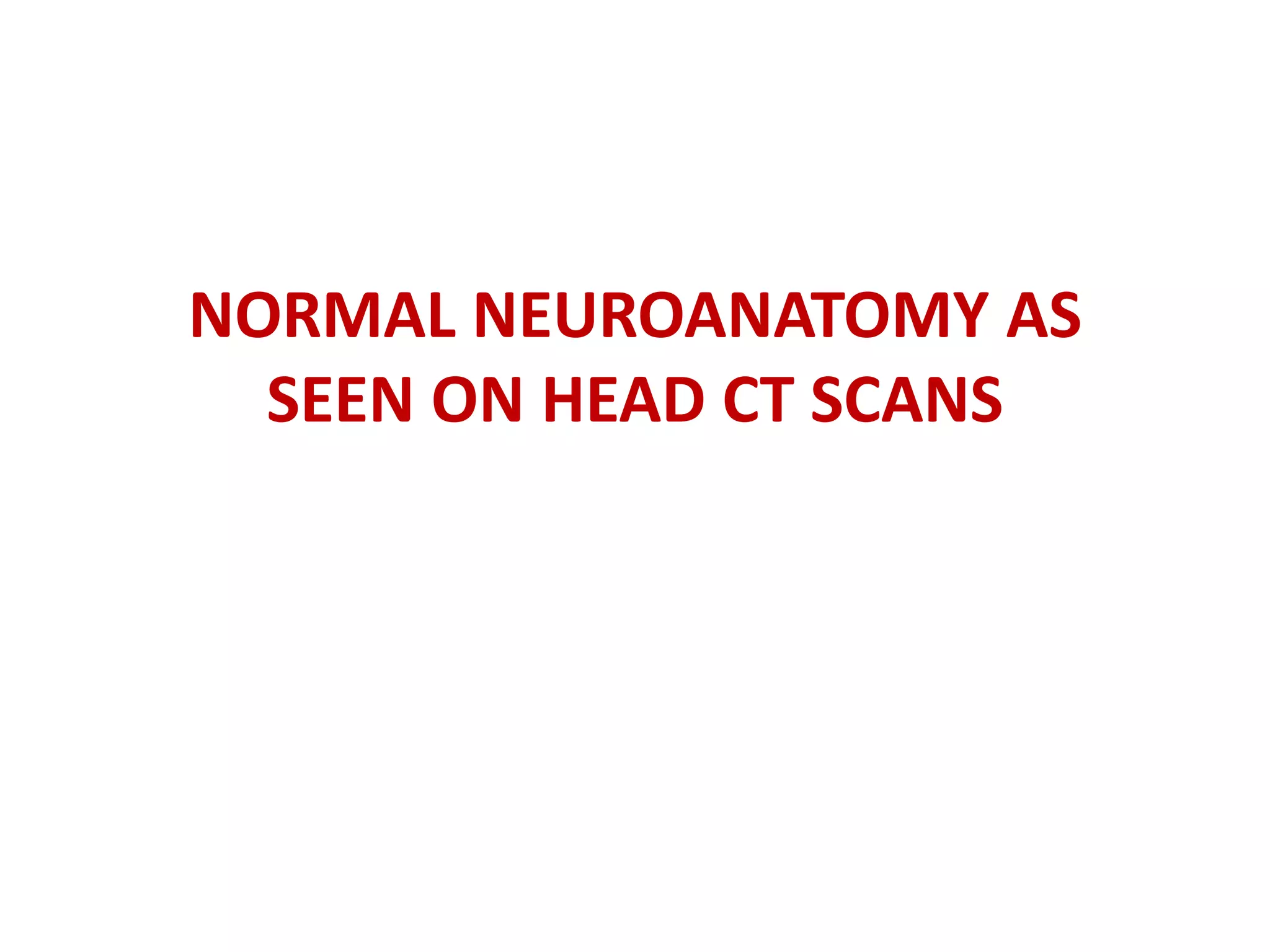 BASICS of CT Head | PPTX