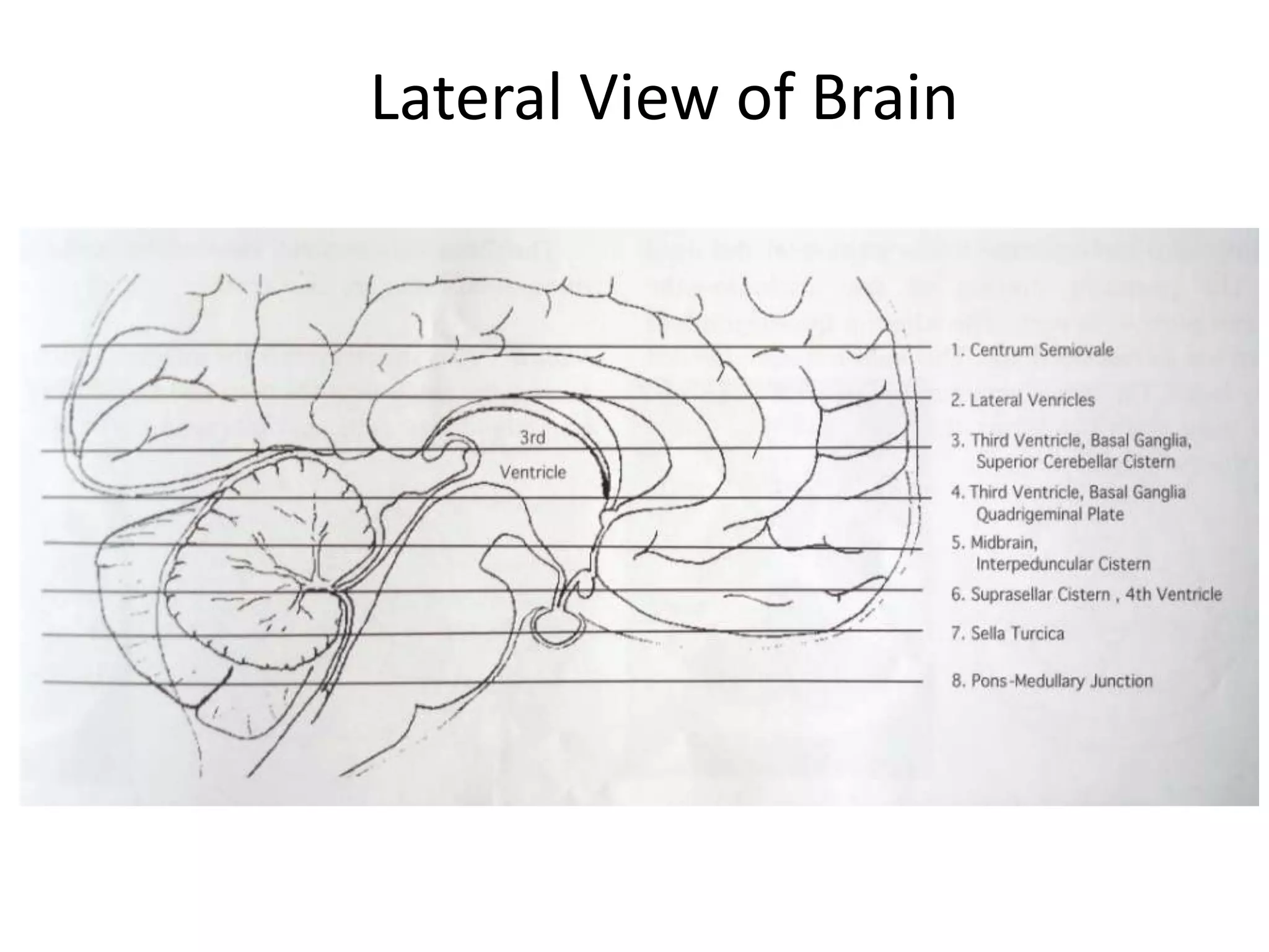 BASICS of CT Head | PPTX