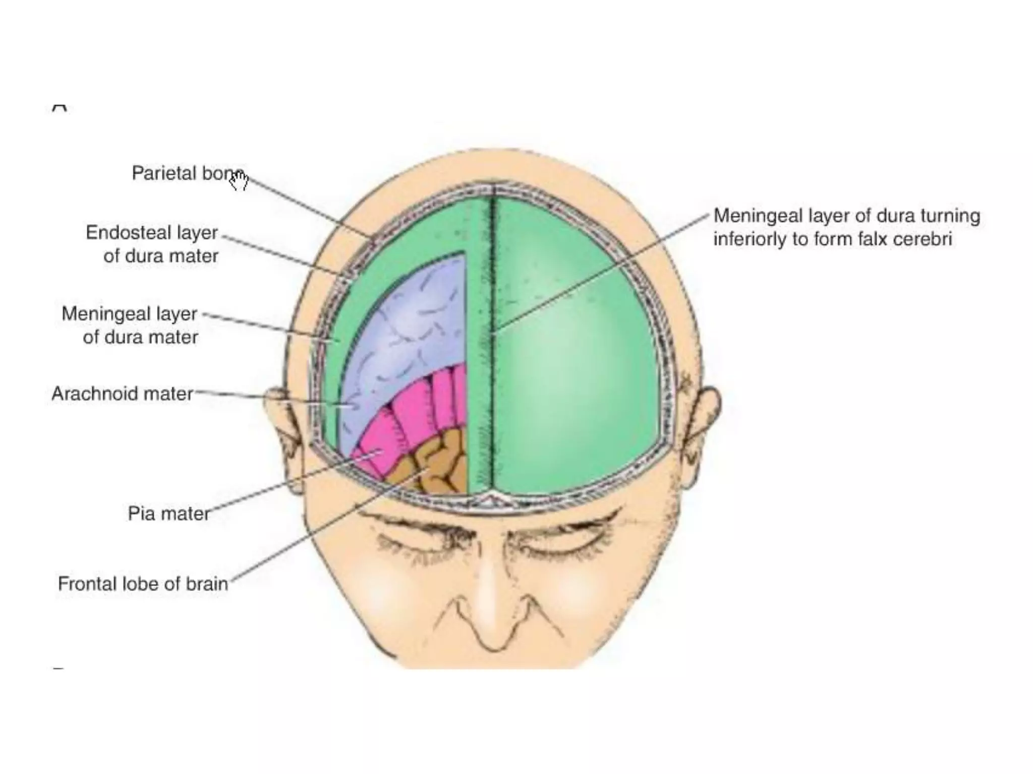 BASICS of CT Head | PPTX