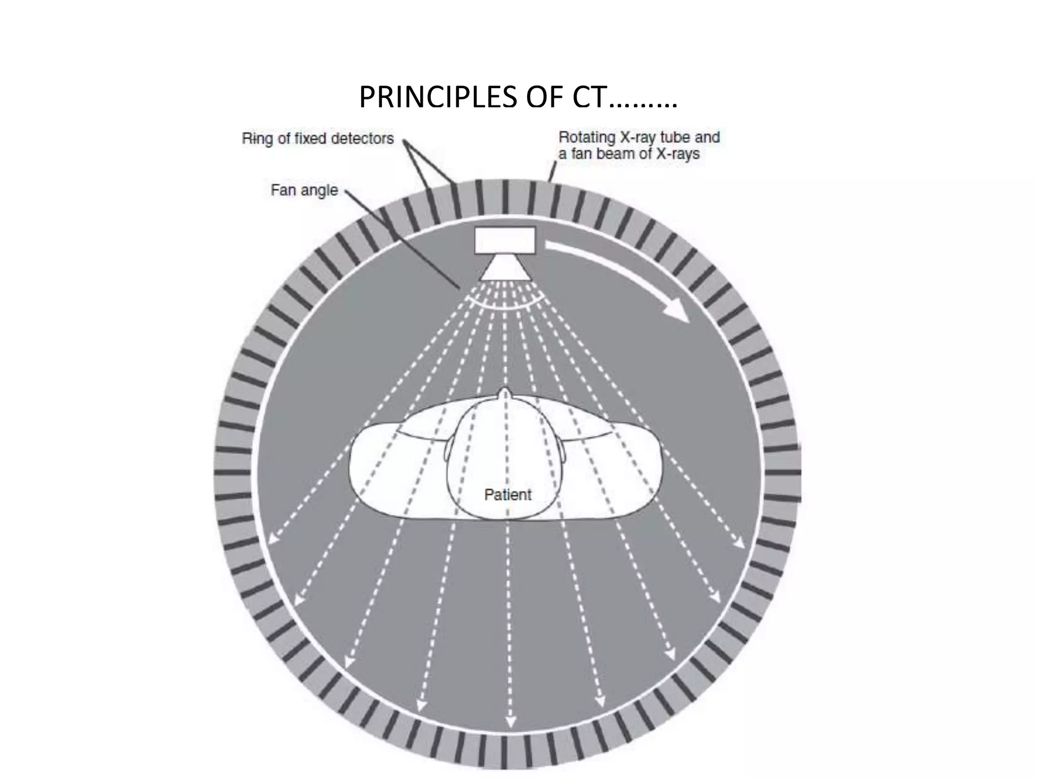 BASICS of CT Head | PPTX