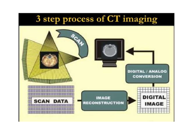 BASICS of CT Head | PPTX