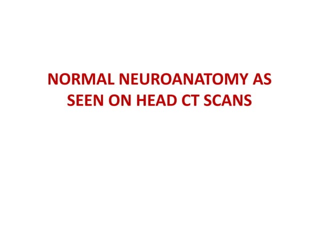 BASICS of CT Head | PPTX