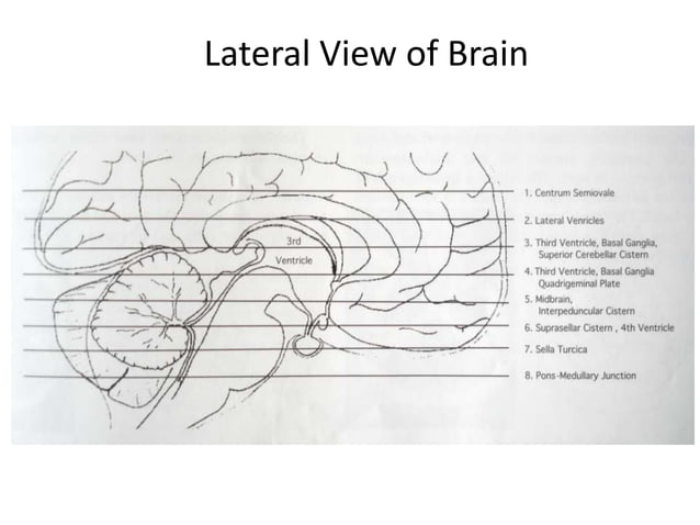 BASICS of CT Head | PPTX