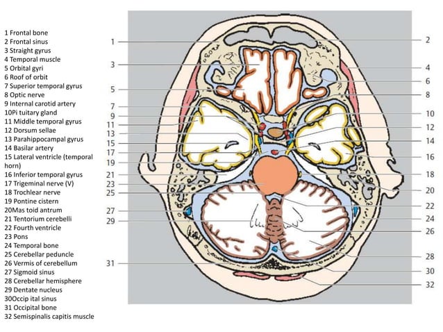 BASICS of CT Head | PPTX