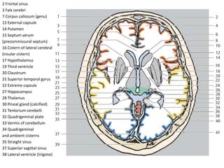 BASICS of CT Head | PPT
