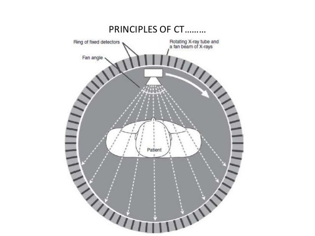 BASICS of CT Head