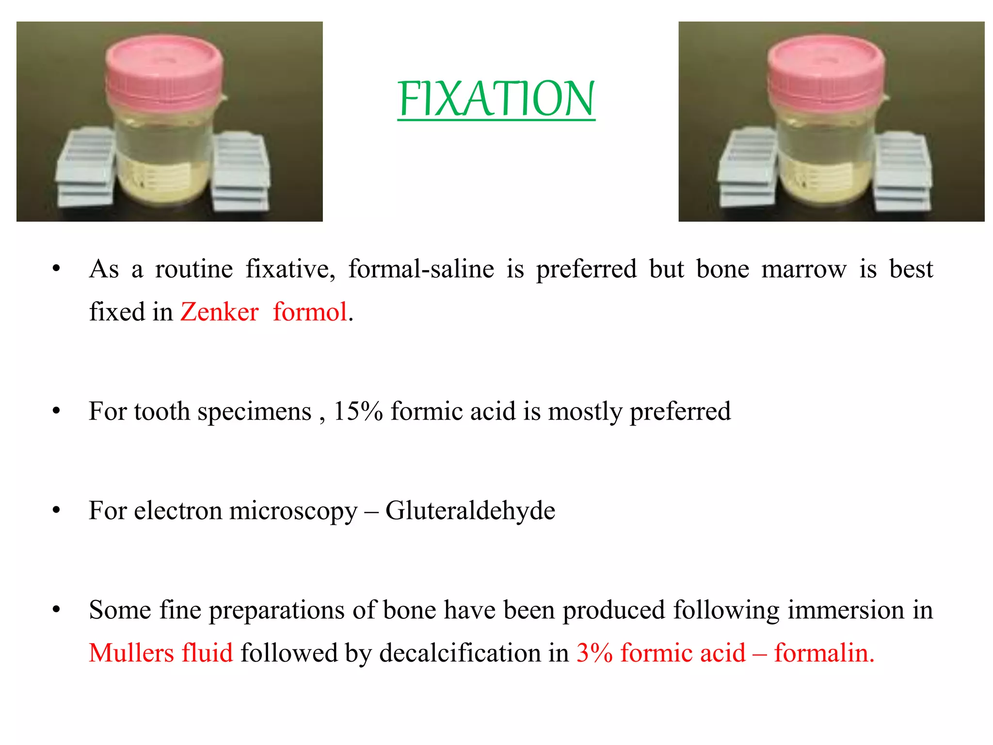 DECALCIFICATION | PPTX