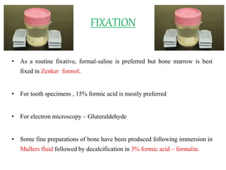 DECALCIFICATION | PPTX