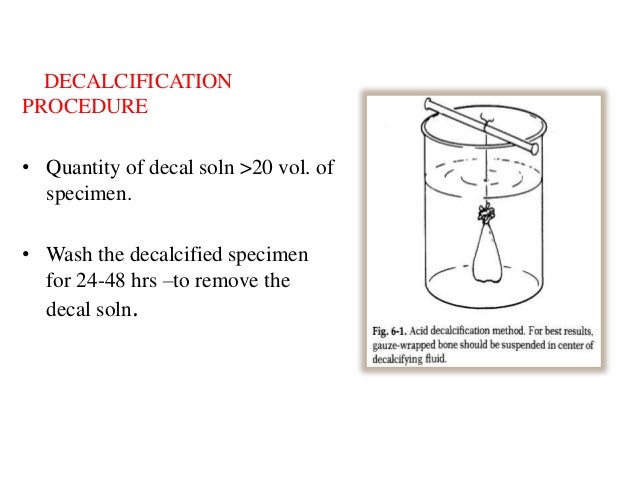 DECALCIFICATION