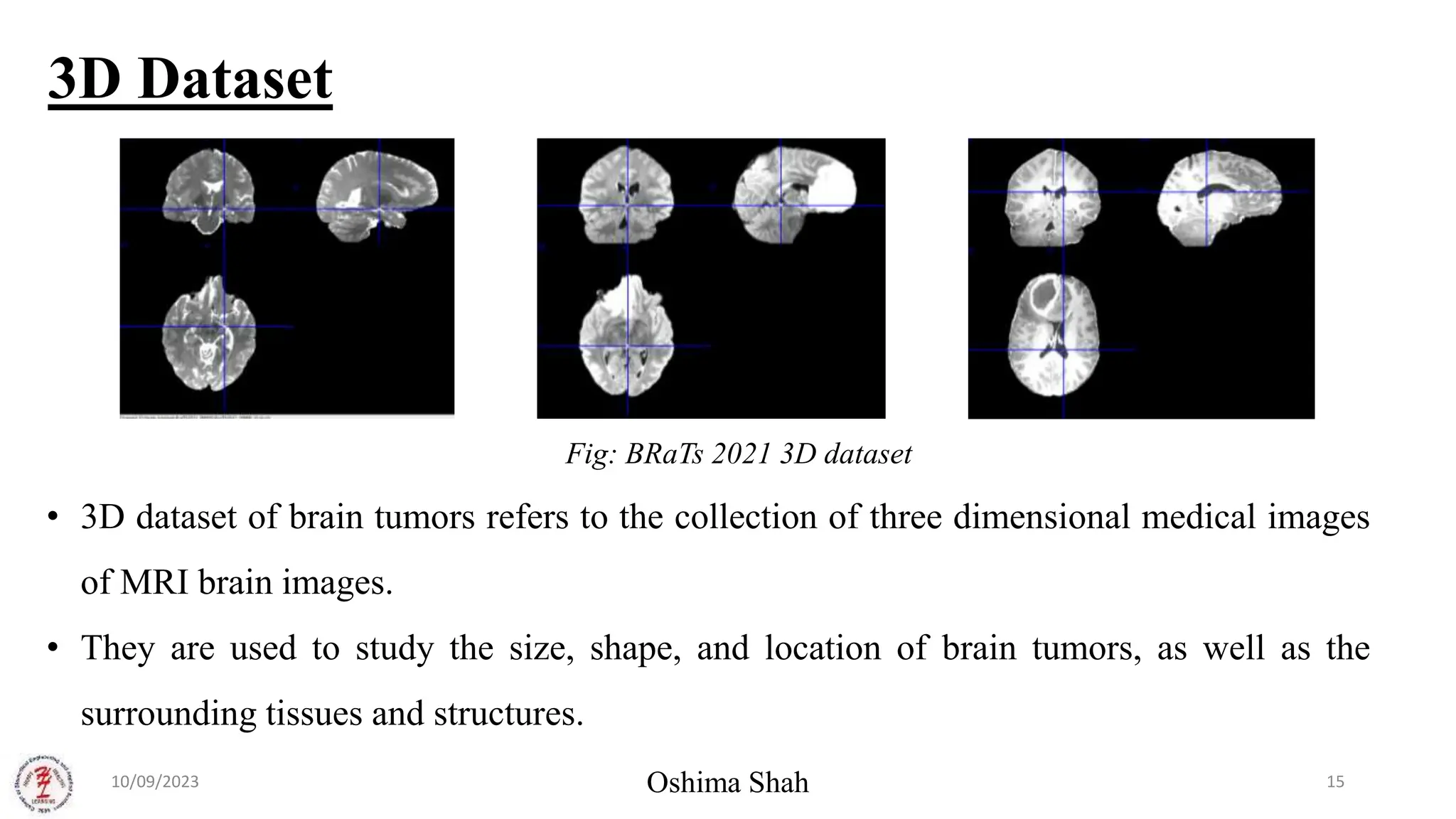 Final Defense ppt (brats)of brain tumor segmentation.pptx