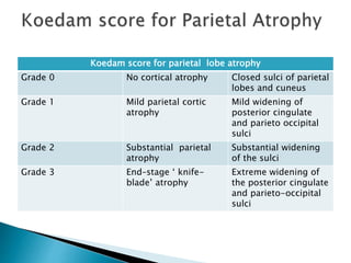 Radiological evaluation of Dementia | PPT