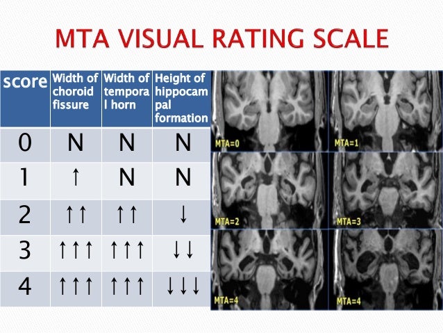 Radiological evaluation of Dementia