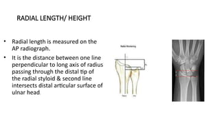 Fractures of distal end radius management | PPTX