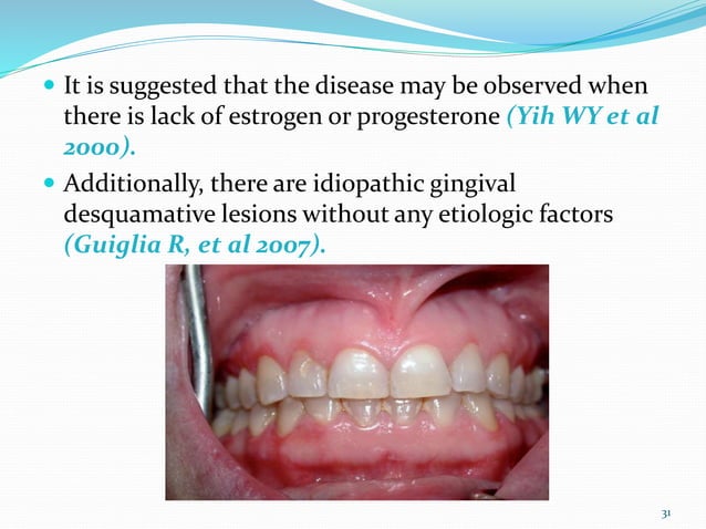 Desquamative Gingivitis (detailed presentation.pptx | Dental Health ...