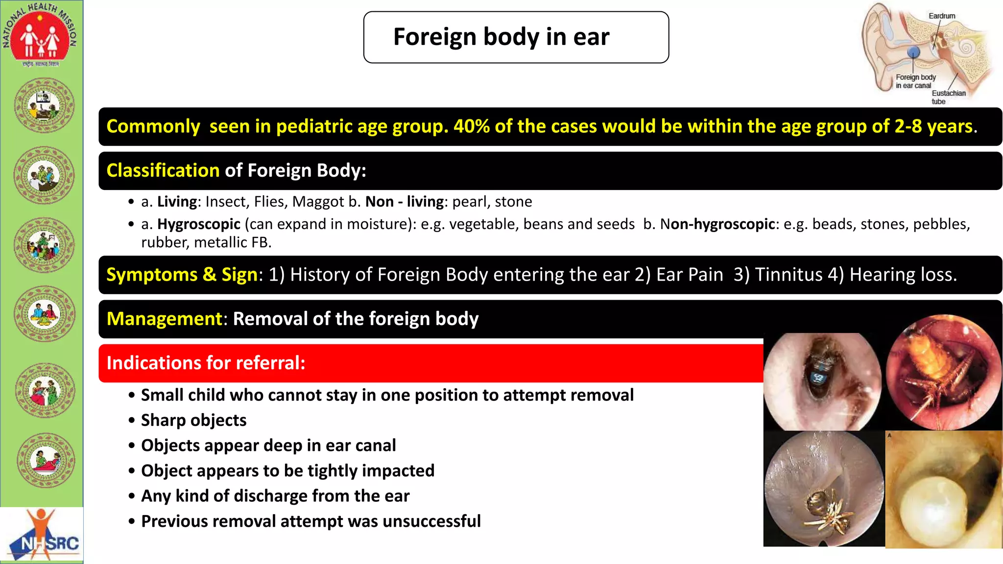 Final Diseases of EAR.pptx