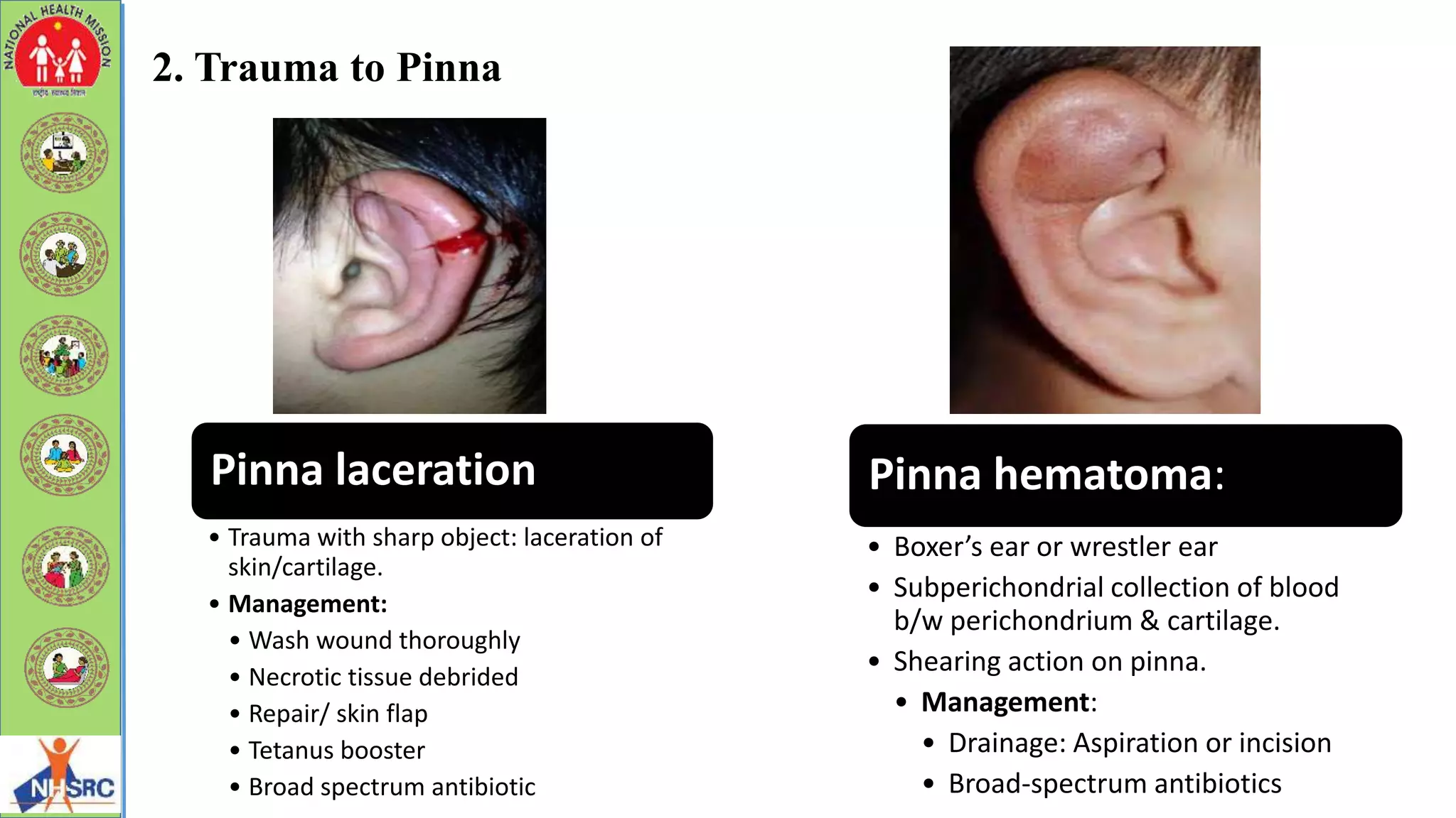 Final Diseases of EAR.pptx