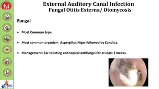 Final Diseases of EAR.pptx