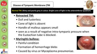 Final Diseases of EAR.pptx