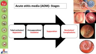 Final Diseases of EAR.pptx