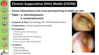 Final Diseases of EAR.pptx