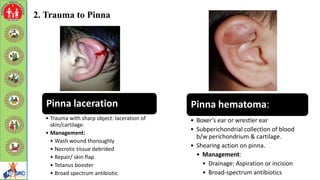 Final Diseases of EAR.pptx