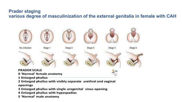Seminar on DSD | PPT