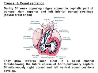 Transposition of Great Arteries | PPT