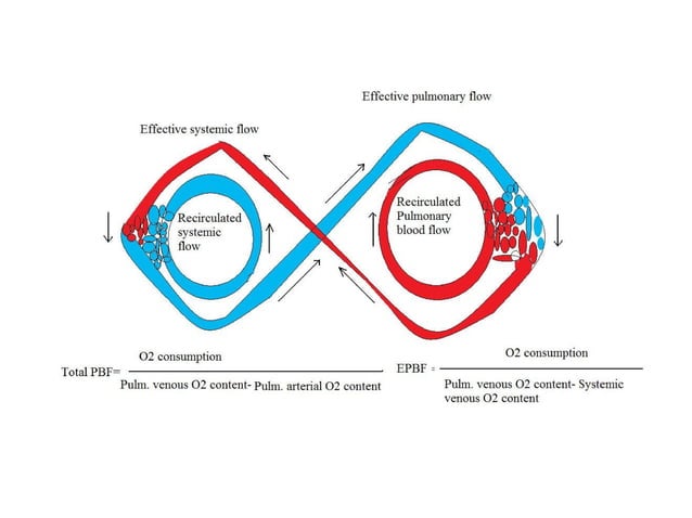 Transposition Of Great Arteries Ppt