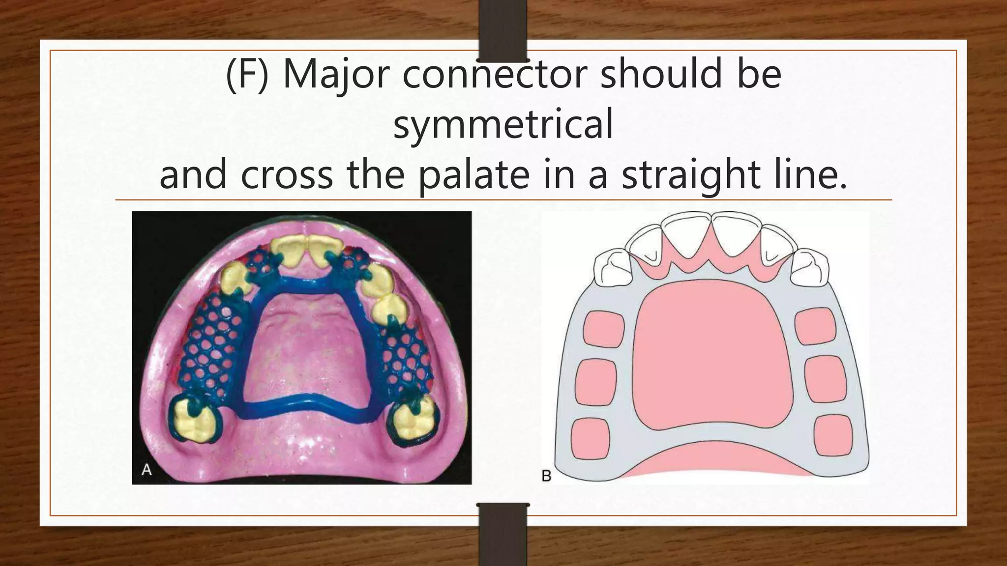 Major and minor connectors | PPTX