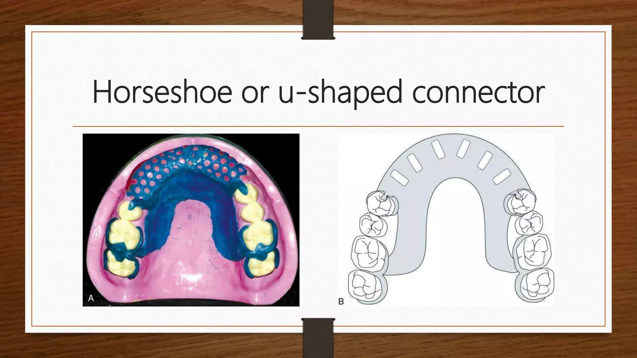 Major and minor connectors | PPTX