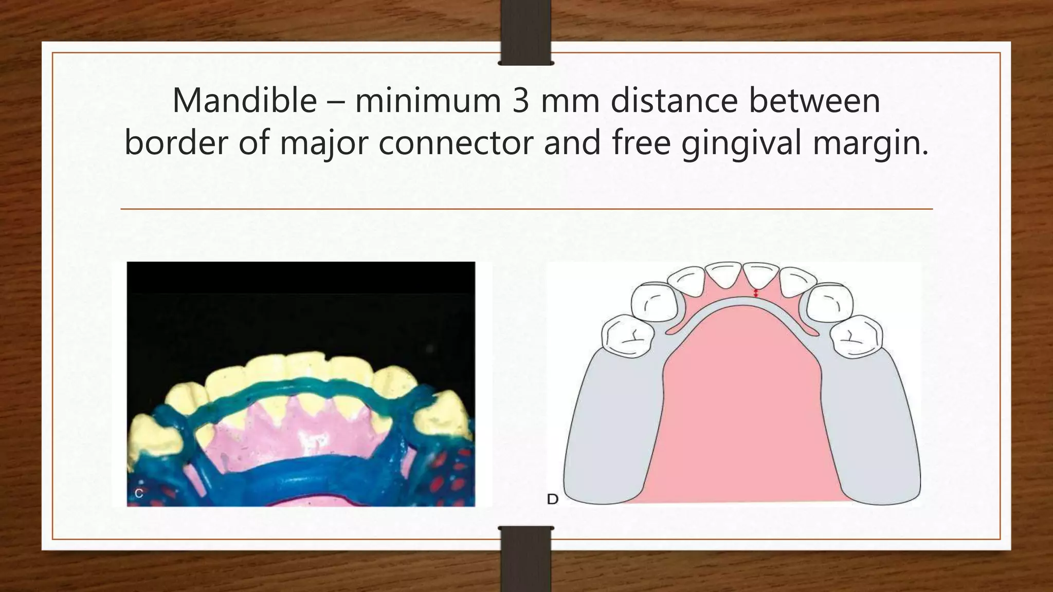 Major and minor connectors | PPTX